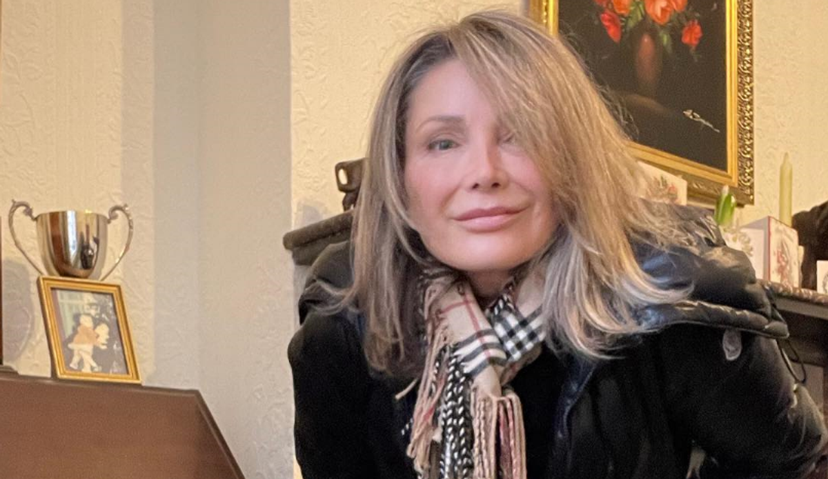 Nina chcela novú tvár, aby vyzerala mladšie: Toto jej dokázali urobiť ...