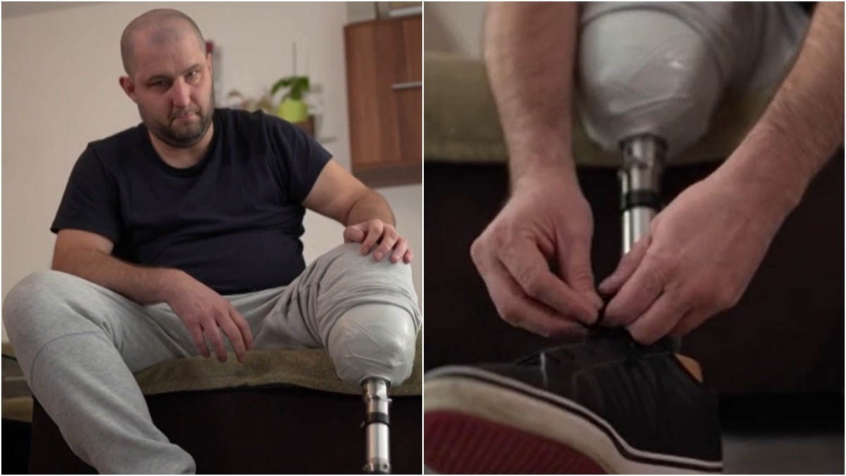 Stál na prahu smrti: Jozef v Bez servítky prehovoril o tom, ako prišiel o NOHU! | JOJ