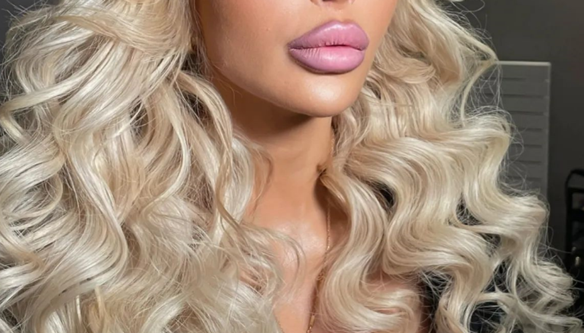 Zbohom kačacie pery: Sexi Slovenka sa zbavila veľkých pier...TOTO jej ...